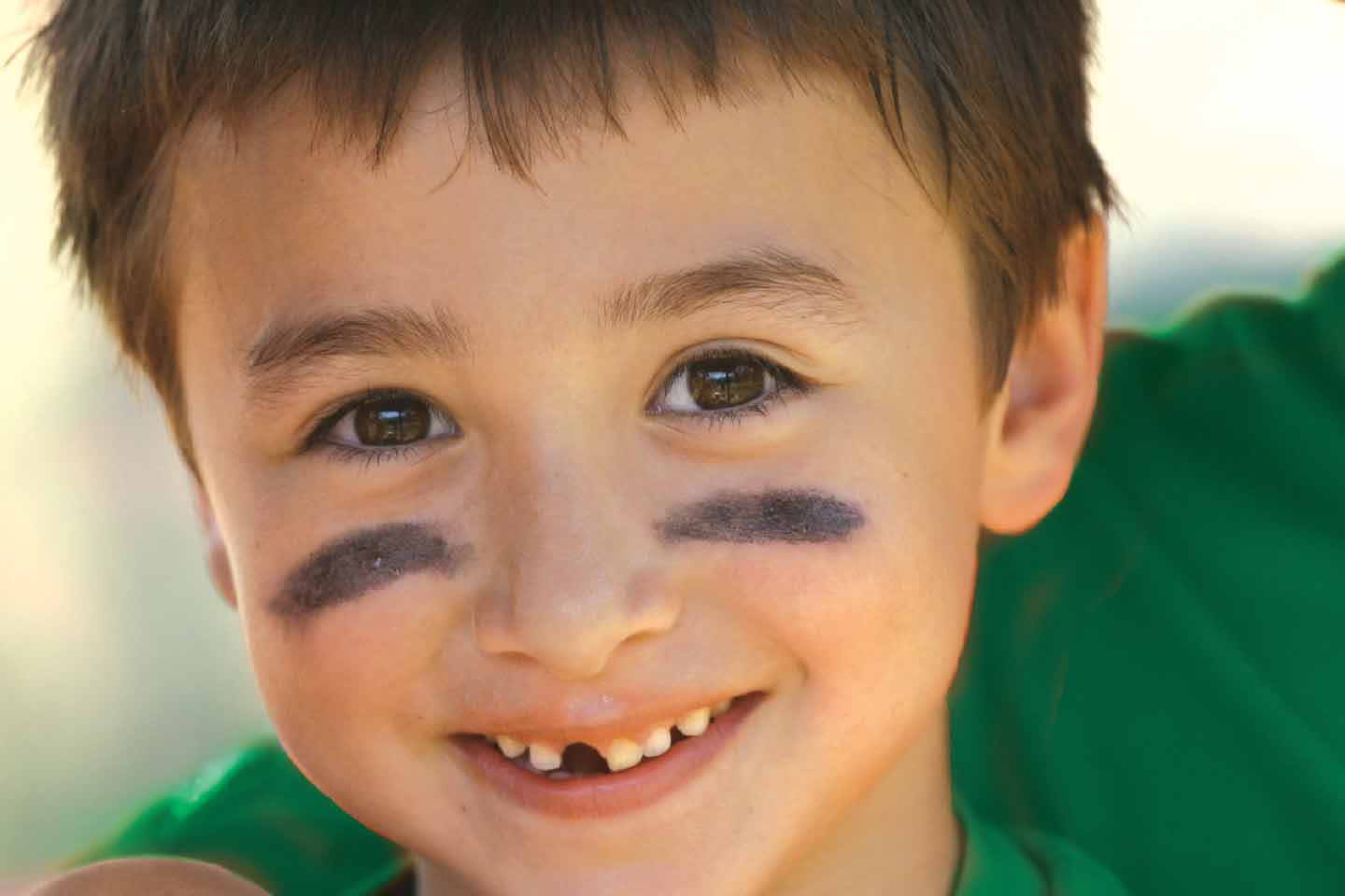 Facial Trauma HealthScopeHealthScope Facial Trauma HealthScopeHealthScope