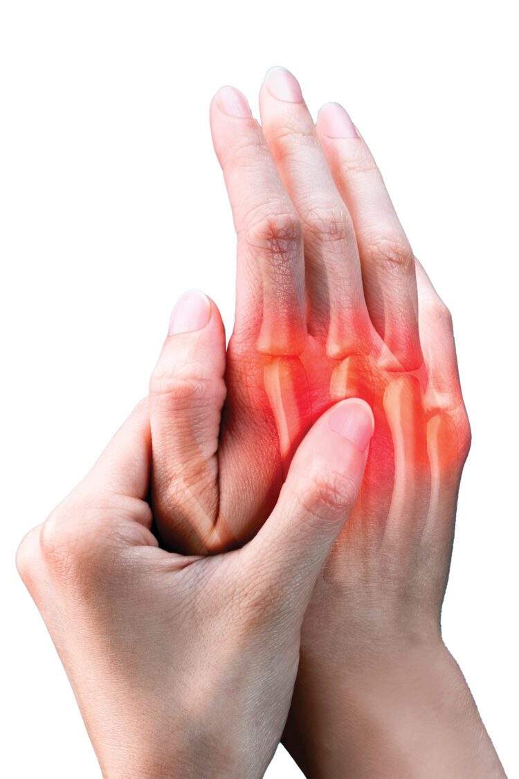 Understanding Arthritis - HealthScope® Magazine